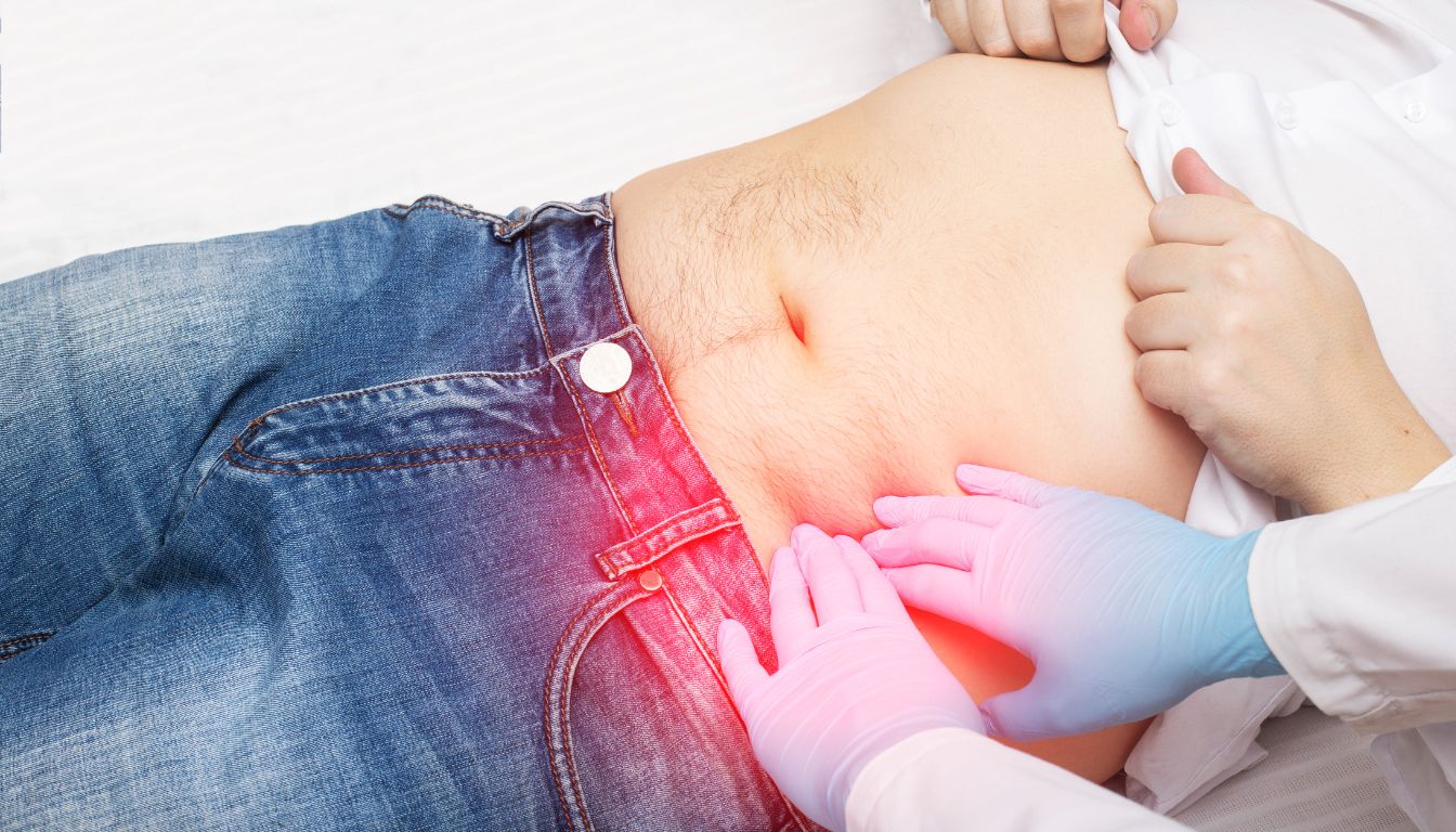 Everything You Need to Know About Diverticulitis: Symptoms, Causes, and ...